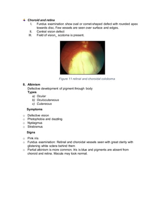 Uveitis (Classification, Panuveitis, Endophthalmitis, Panophthalmitis ...