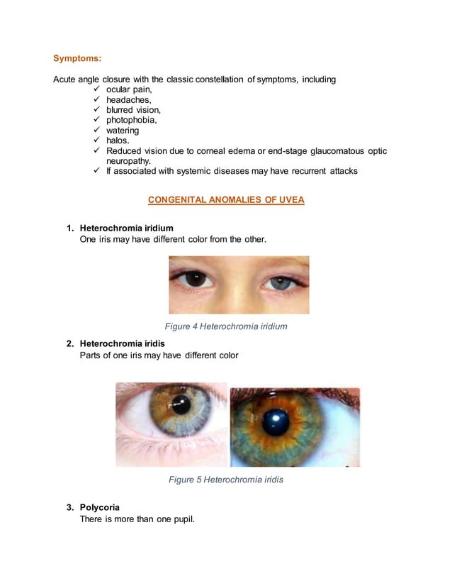 Uveitis (Classification, Panuveitis, Endophthalmitis, Panophthalmitis ...