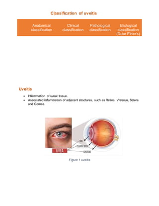 Anterior Uveitis Posterior Uveitis And Panuveitis Etiology Symptoms