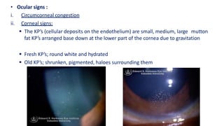 uveitis.pptx