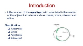 uveitis.pptx