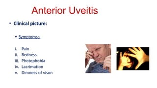 uveitis.pptx