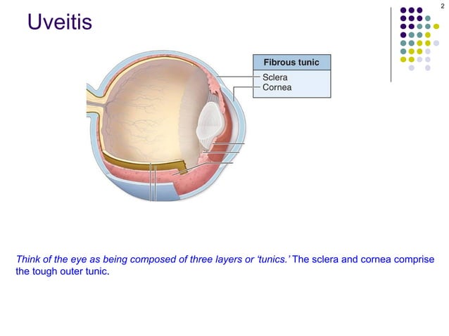 Uveitis in the eye anterior uvitis and posterior uveitis | PDF | Eye ...