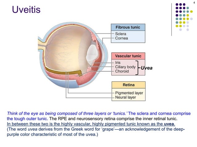 Uveitis in the eye anterior uvitis and posterior uveitis | PDF | Eye ...