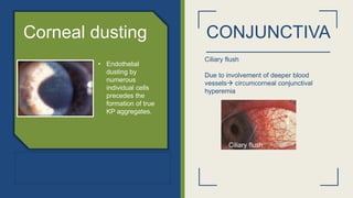 Uveitis its clinical features and management.pptx