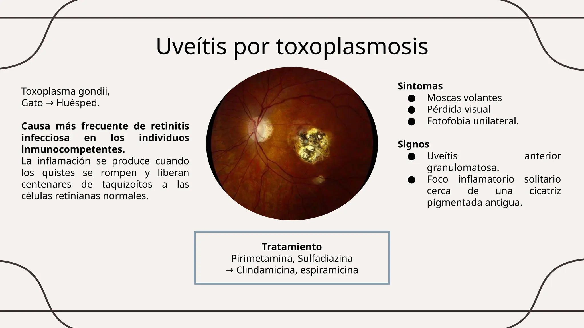 UVEITIS PARA OFTALMOLOGIA, Su tratamiento | PPT