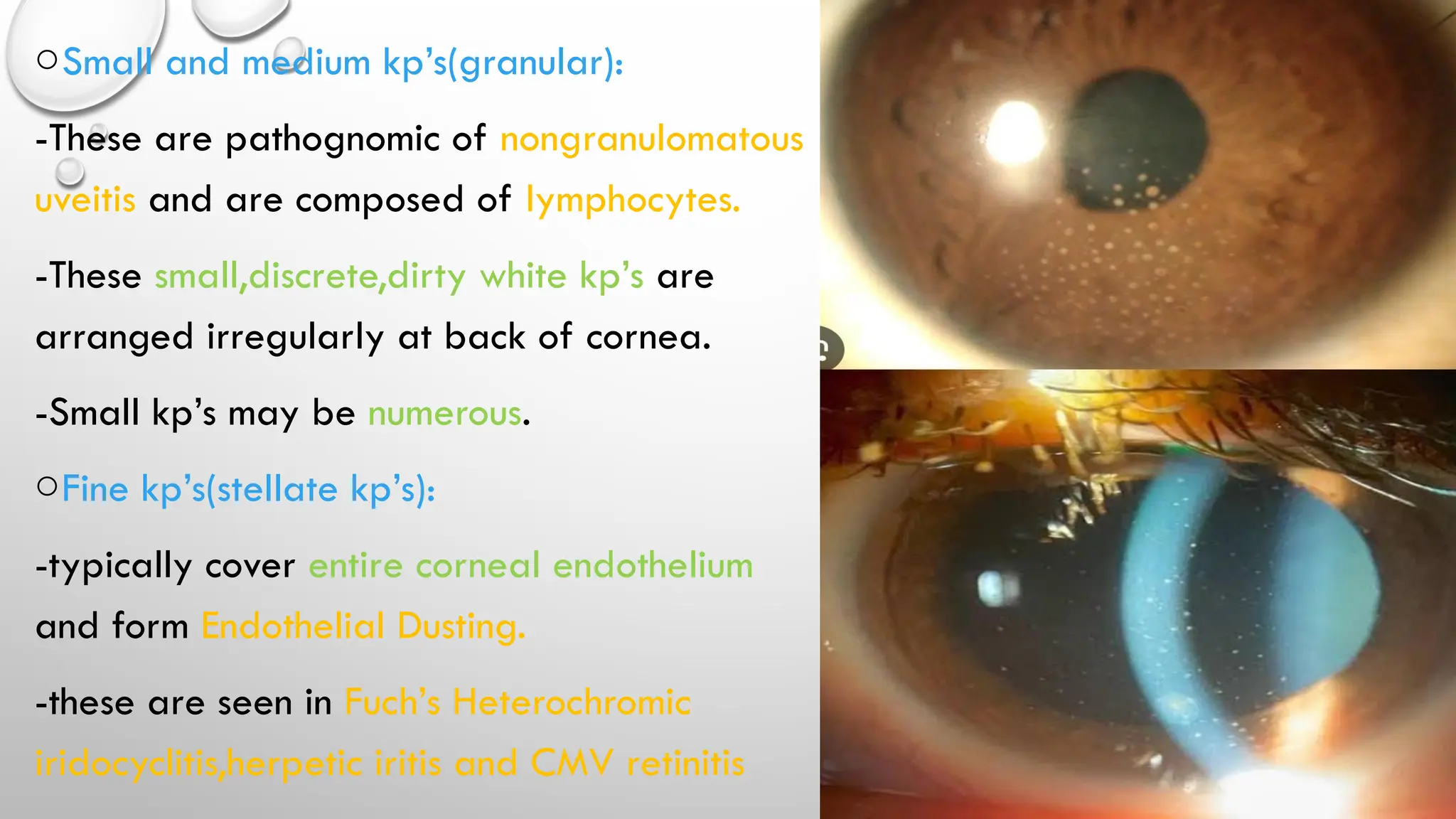 uveitis of the anterior segment and posterior segment | PPTX | Eye and ...