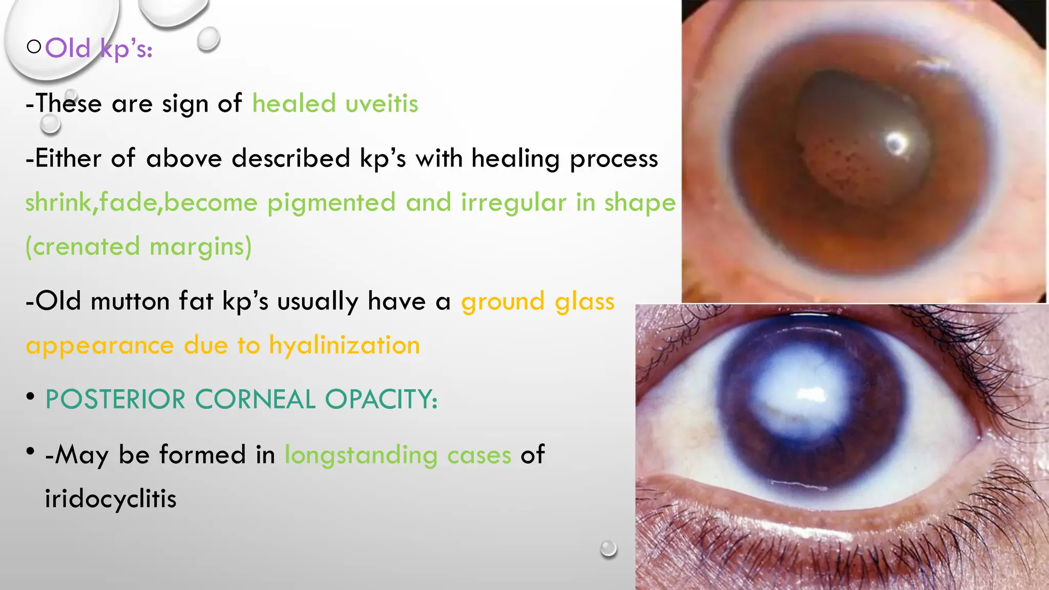 uveitis of the anterior segment and posterior segment | PPTX | Eye and Vision Conditions ...