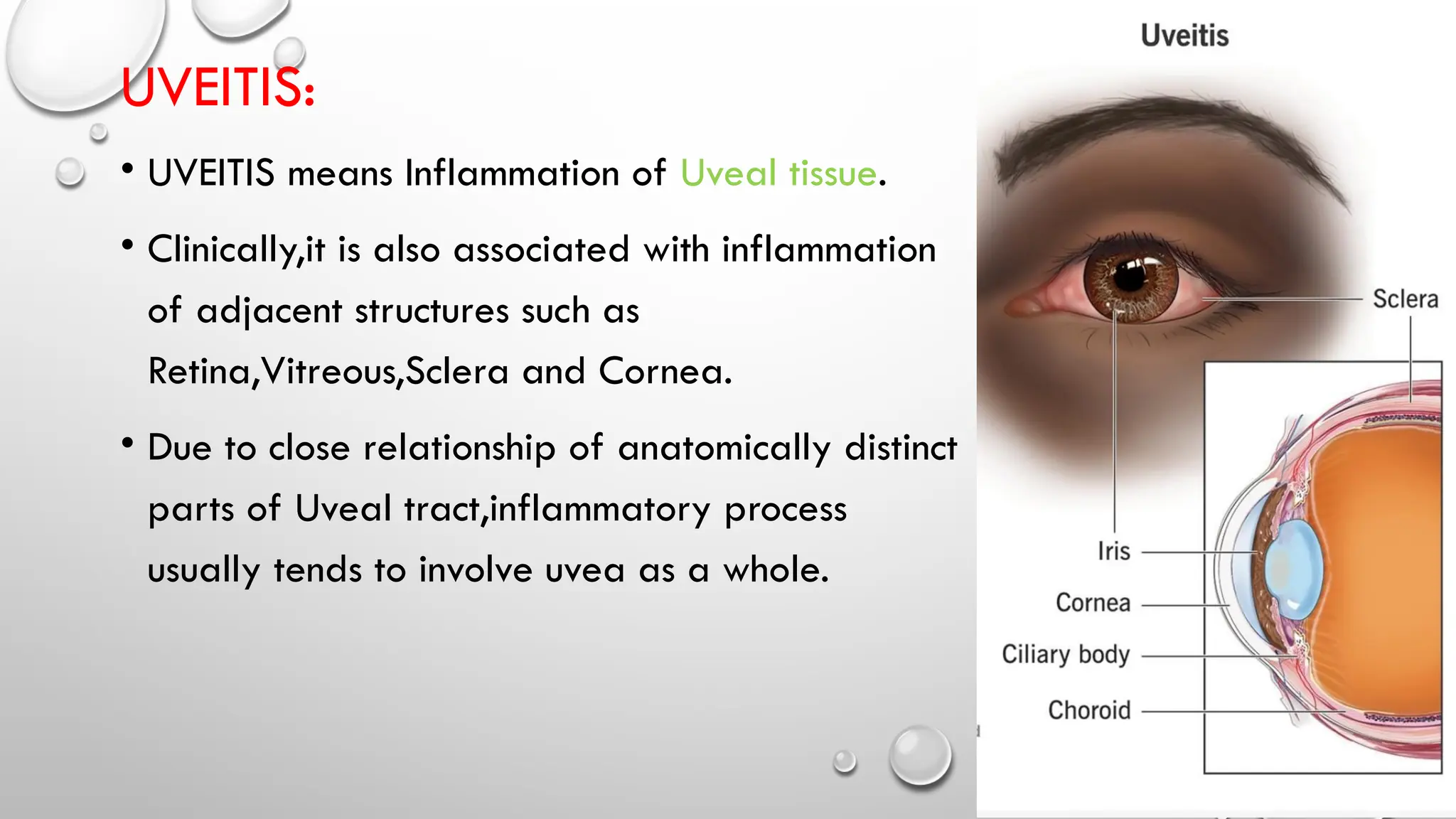 uveitis of the anterior segment and posterior segment | PPTX | Eye and Vision Conditions ...