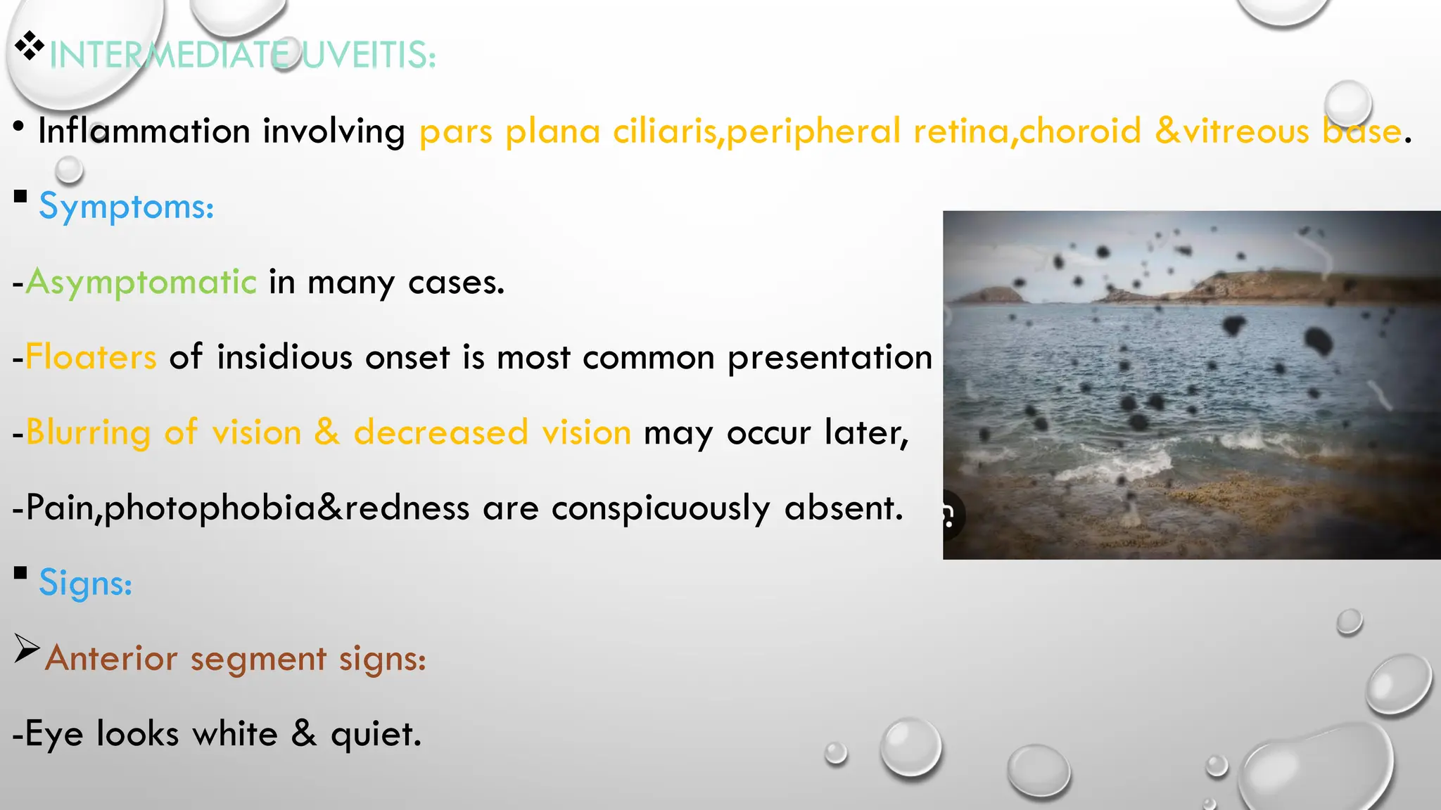 uveitis of the anterior segment and posterior segment | PPTX