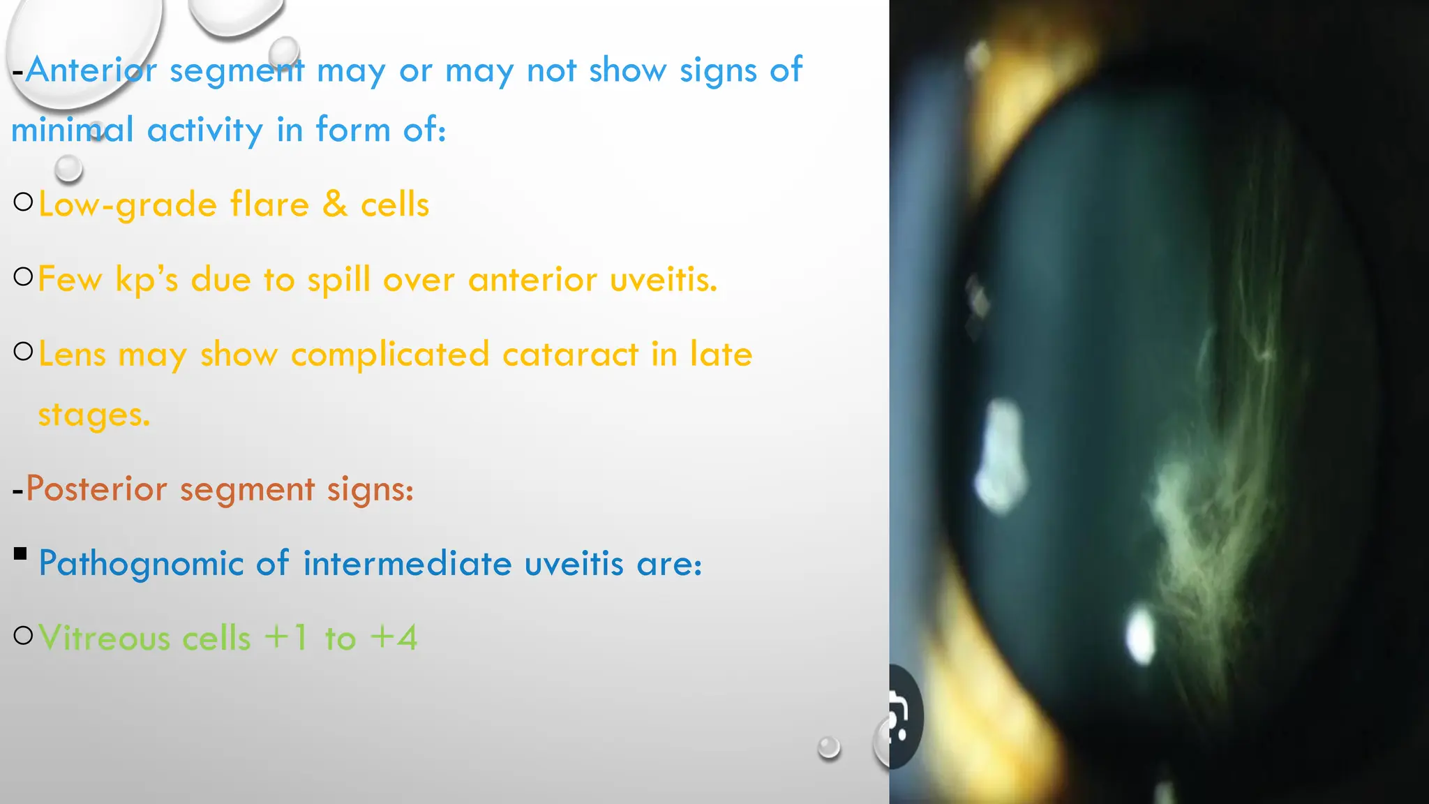 uveitis of the anterior segment and posterior segment | PPTX | Eye and ...