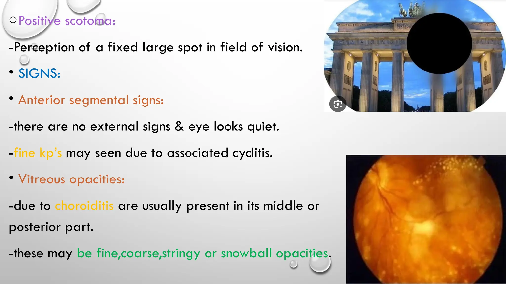 uveitis of the anterior segment and posterior segment | PPTX | Eye and Vision Conditions ...