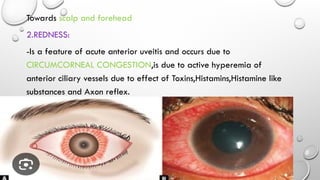 uveitis of the anterior segment and posterior segment | PPTX