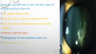 uveitis of the anterior segment and posterior segment | PPTX