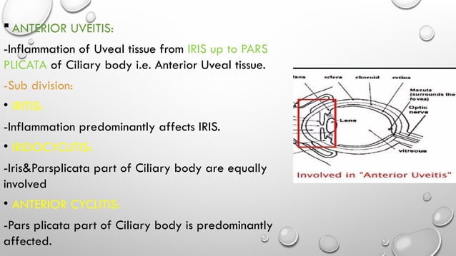 uveitis of the anterior segment and posterior segment | PPTX | Eye and ...