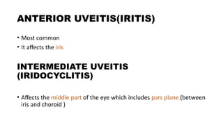 UVEITIS exam reference notes important.pptx