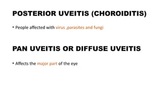 UVEITIS exam reference notes important.pptx