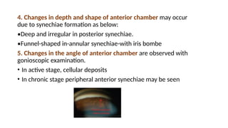 classification of uveitis and any uveitis | PPTX