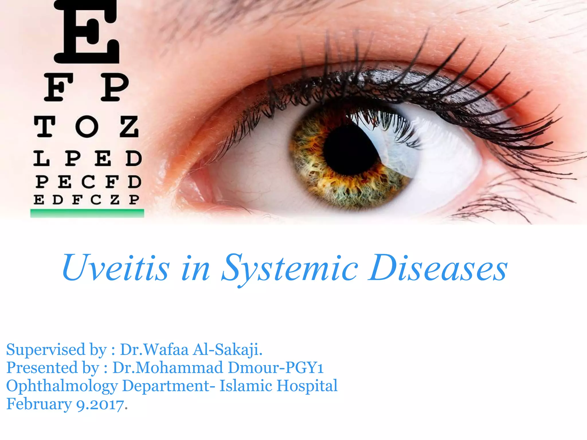 Uveitis | PPTX