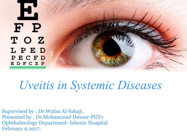 Uveitis | PPTX
