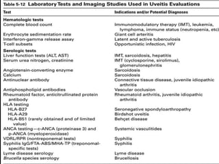 Uveitis | PPTX