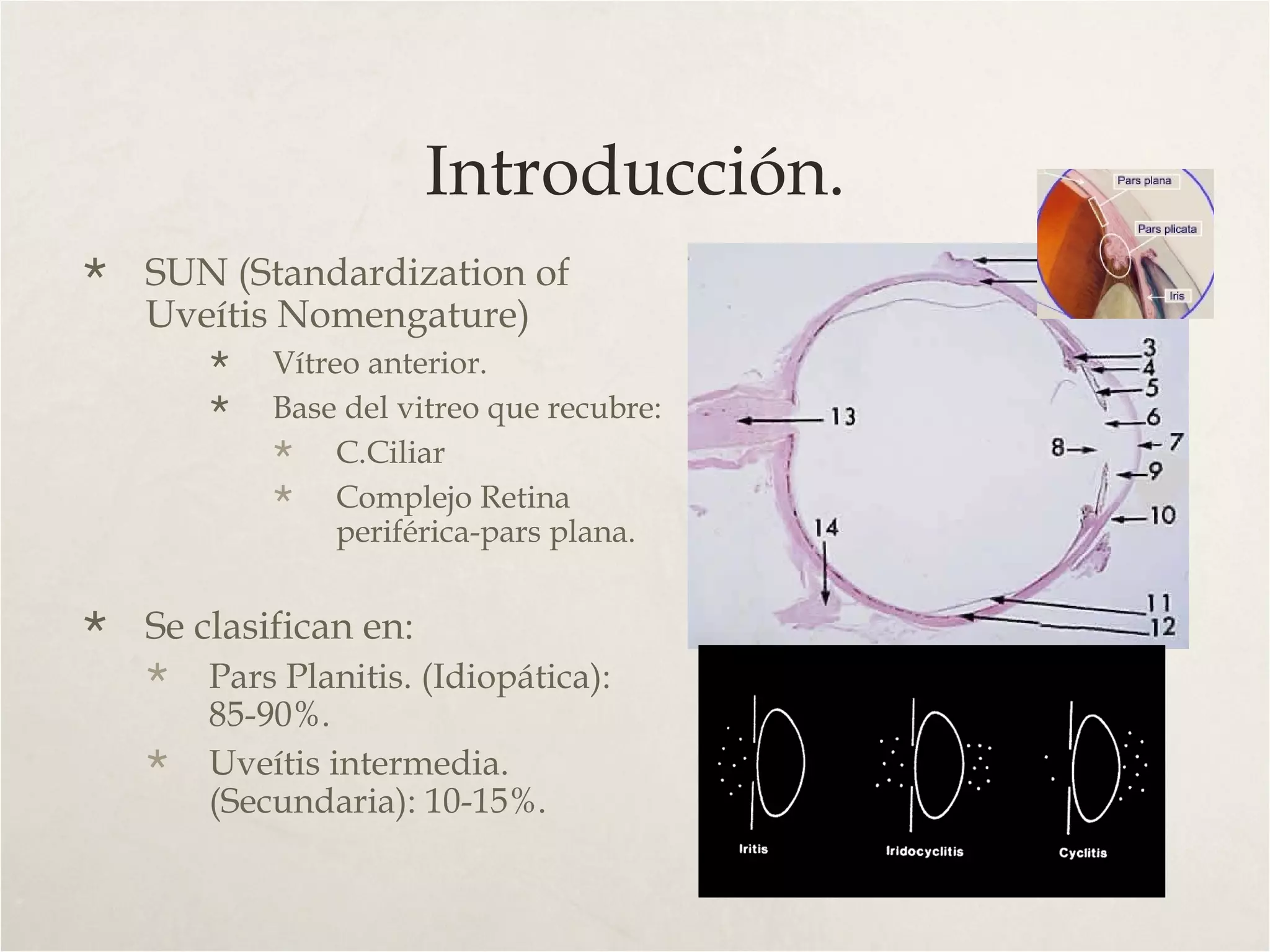 Uveitis Intermedias | PPT | Eye and Vision Conditions | Diseases and ...