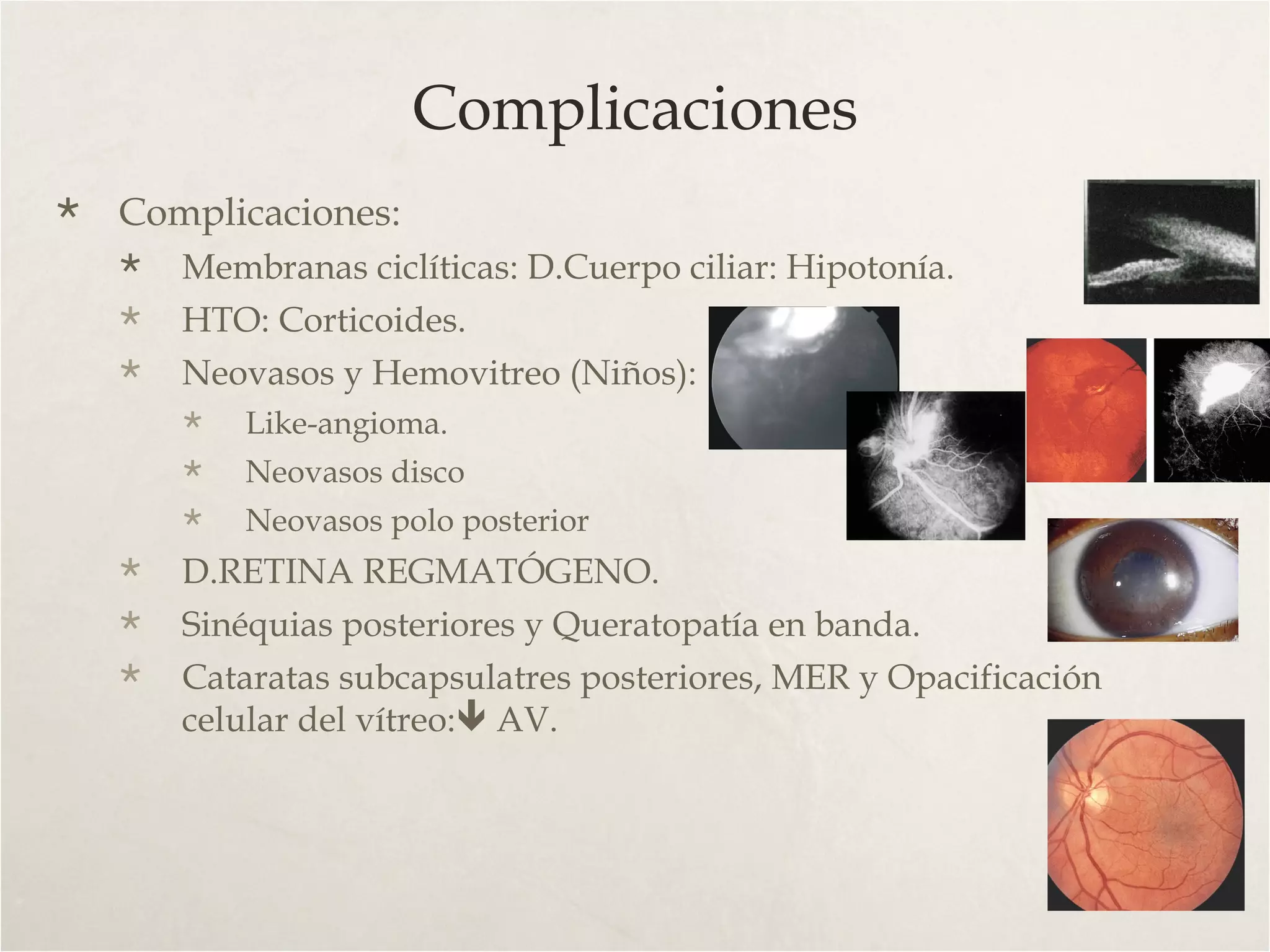 Uveitis Intermedias | PPT | Eye and Vision Conditions | Diseases and ...