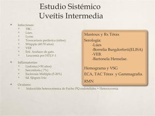 Uveitis Intermedias | PPT