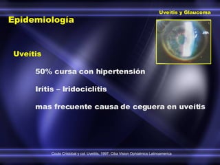 Uveitis Y Glaucoma | PPT