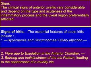 Uveitis 2lectures by dr. khaled | PPT
