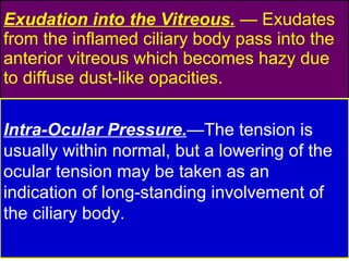 Uveitis 2lectures by dr. khaled | PPT