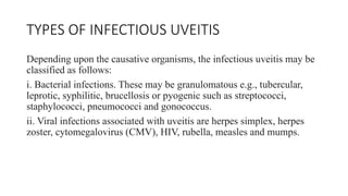 Aetiology and classification of uveitis. | PPTX