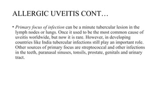 Aetiology and classification of uveitis. | PPTX