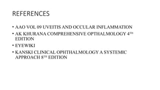 Aetiology and classification of uveitis. | PPTX