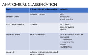 Aetiology and classification of uveitis. | PPTX