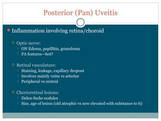 Review of Uveitis | PPT