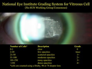 Review of Uveitis | PPT