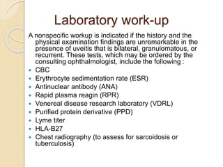 Uveitis basics for undergrads | PPT