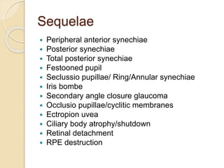 Uveitis basics for undergrads | PPT