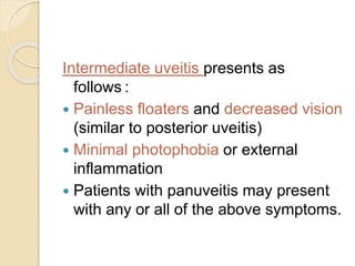 Uveitis basics for undergrads | PPT