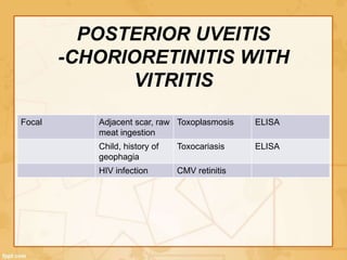 Uveitis classification & clinical features 1 | PPTX