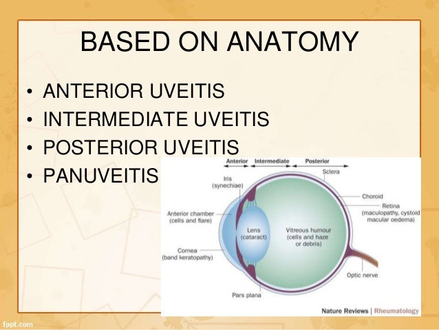 Uveitis classification & clinical features 1