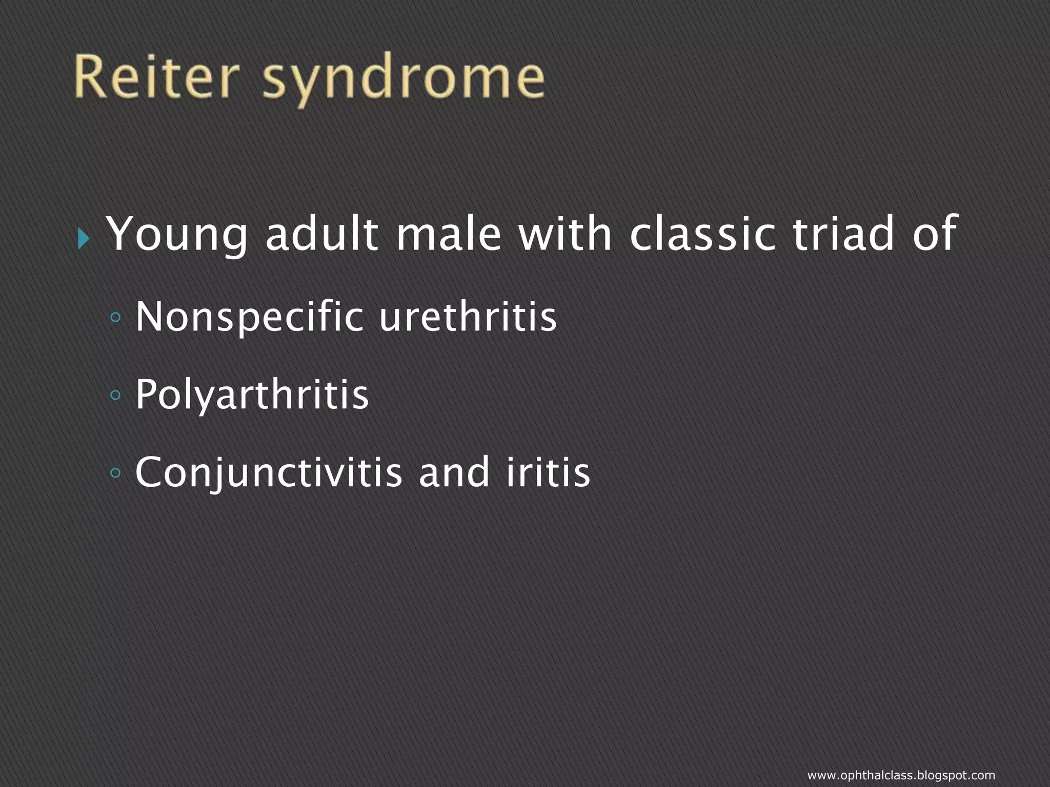 Common Causes Of Uveitis Part2 Pptx