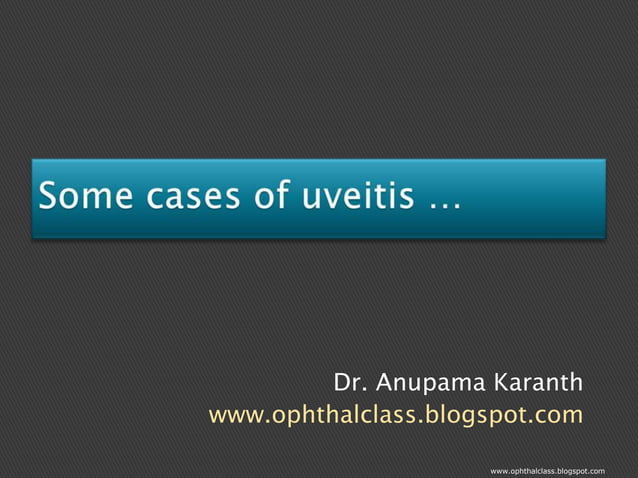 Common Causes of Uveitis Part2 | PPT