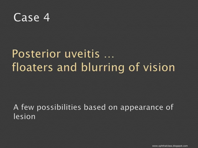 Common Causes of Uveitis Part2 | PPT