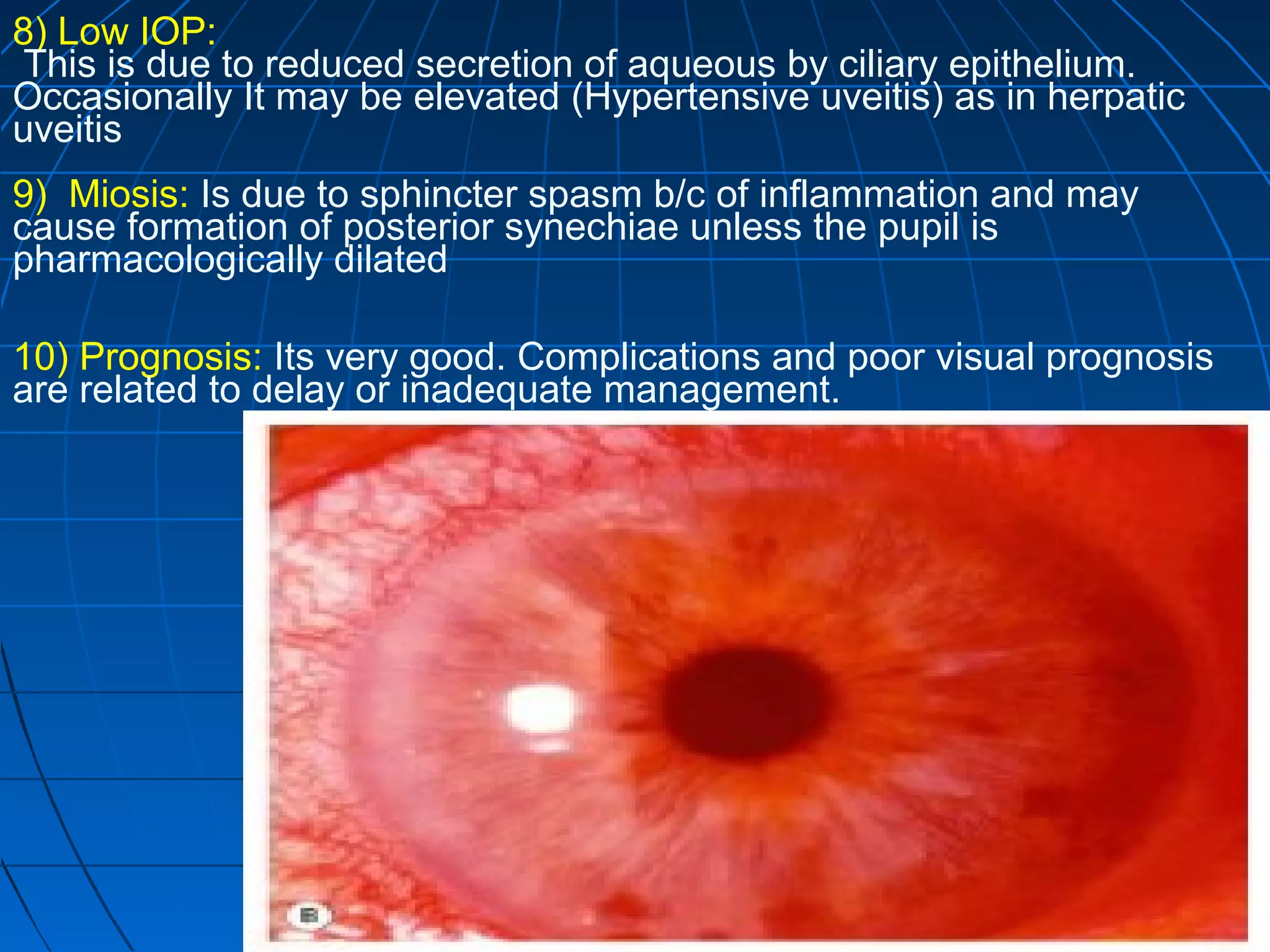 Uveitis Eye presentation- Darayus | PPT