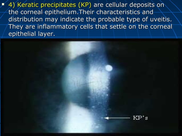 Uveitis Eye presentation- Darayus | PPT