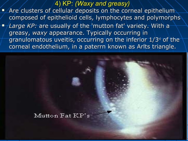 Uveitis Eye presentation- Darayus | PPT