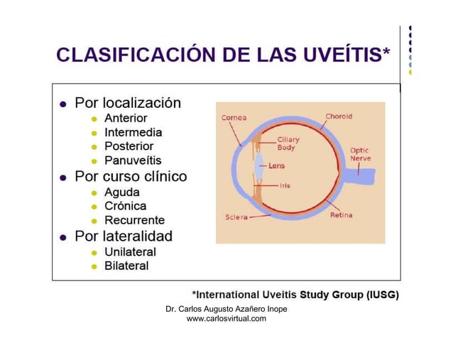 Uveitis Intermedia | PDF | Eye and Vision Conditions | Diseases and ...