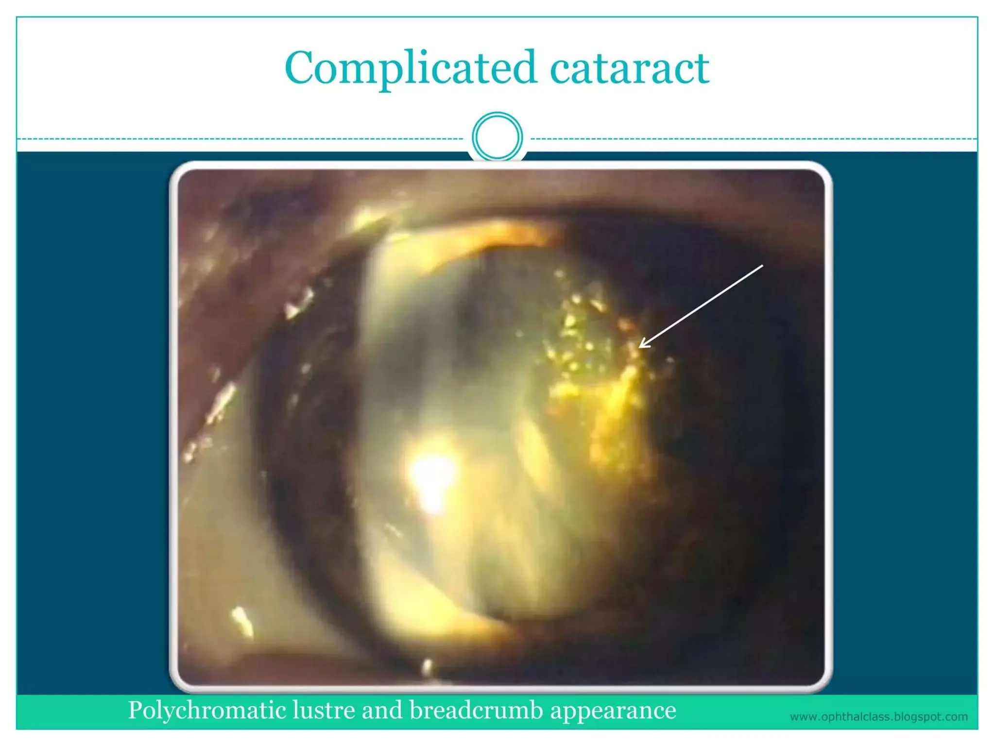 Uveitis management .pdf treatment diagnosis | PDF | Medical Tests ...